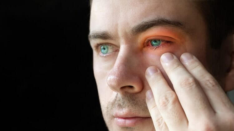 Blepharitis Ashland | Medical Eye Conditions | Tri-State Ophthalmology
